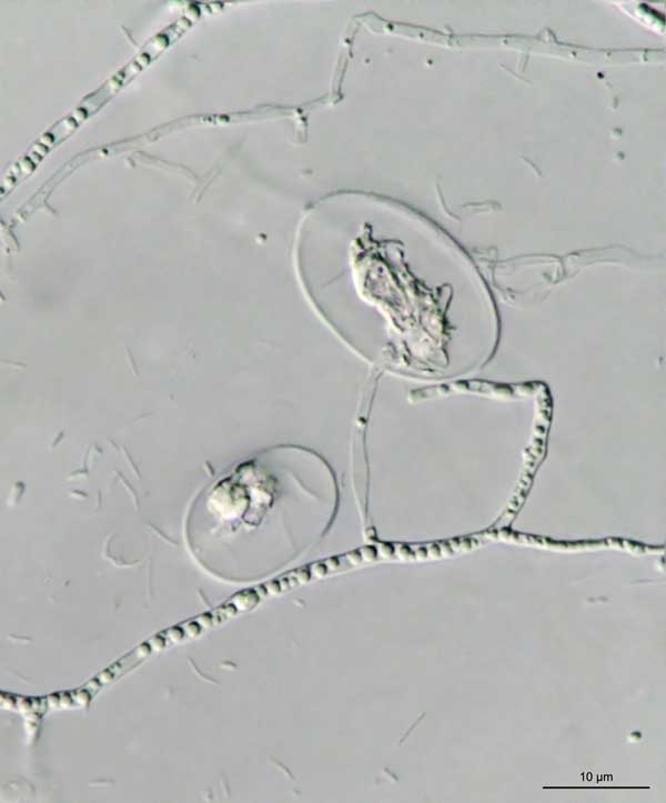 Jochalge Mesotaenium und parasitische Pilze