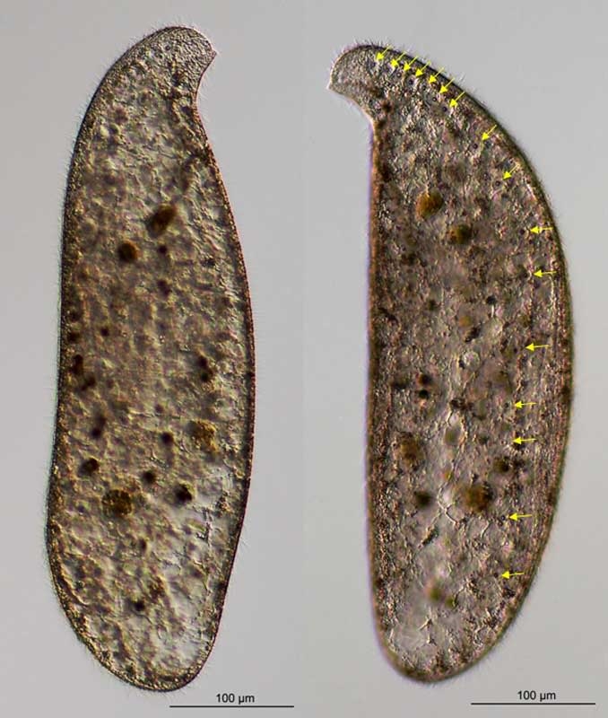 Ciliaten der Gattung Loxodes