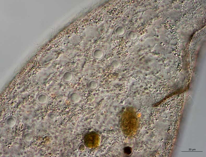 Ciliaten der Gattung Loxodes