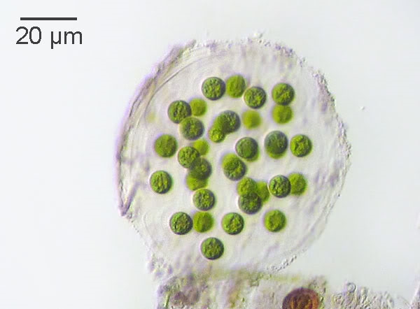 Grünalge aus dem Hochmoor --> Sphaerocystis schroeteri