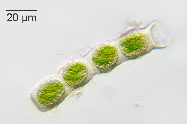 Grünalge --> Microspora sp.