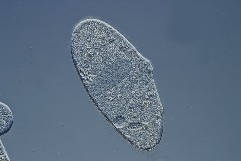 Ciliat, schon mal hier gesehen, aber welcher?