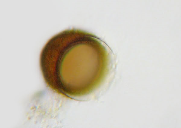 Die Schalenamöbe Pyxidicula patens