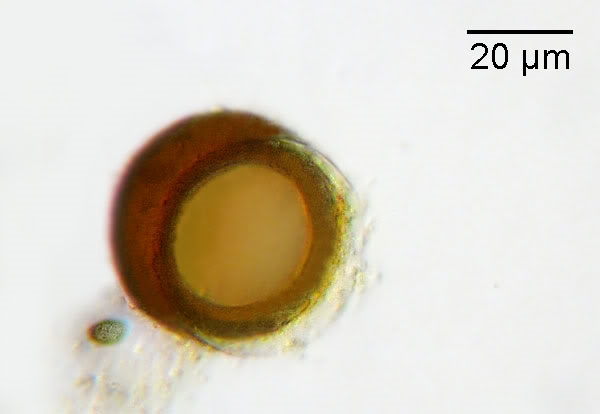 Die Schalenamöbe Pyxidicula patens