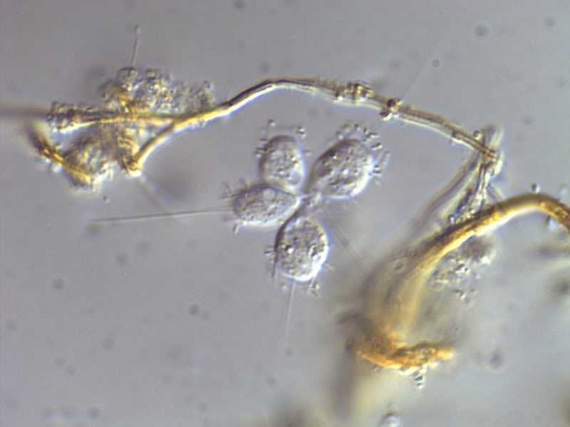 (Sauginfusorien) = Zooflagellat Codosiga botrytis
