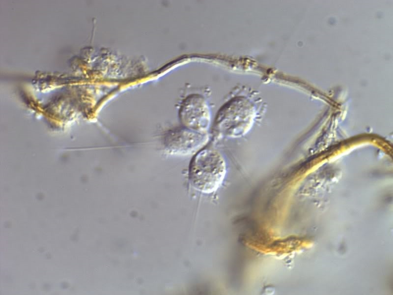 (Sauginfusorien) = Zooflagellat Codosiga botrytis