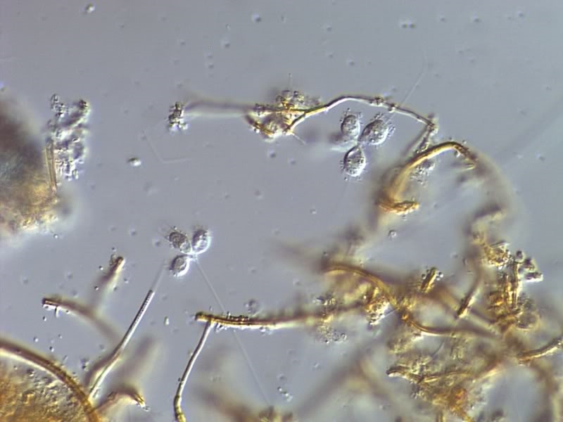 (Sauginfusorien) = Zooflagellat Codosiga botrytis