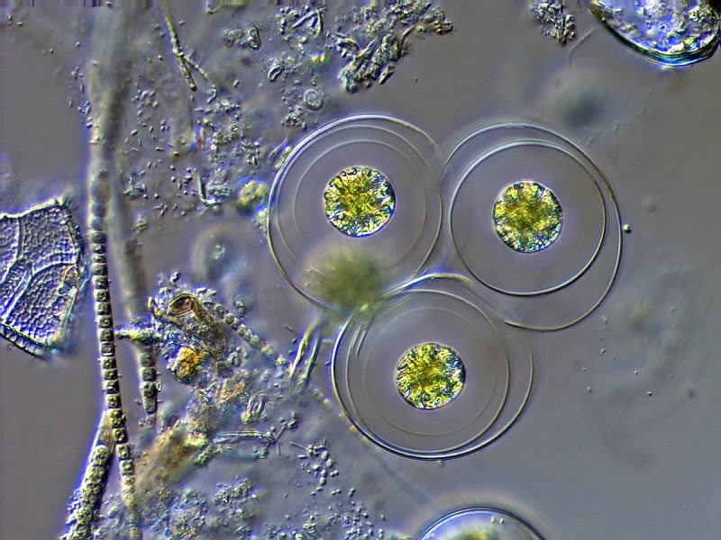 Sternenkugel Asterococcus superbus?