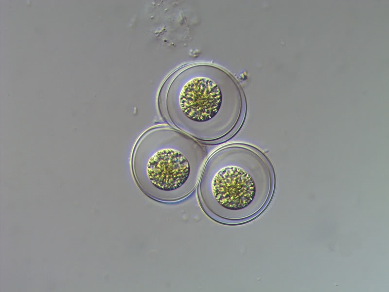 Sternenkugel Asterococcus superbus?