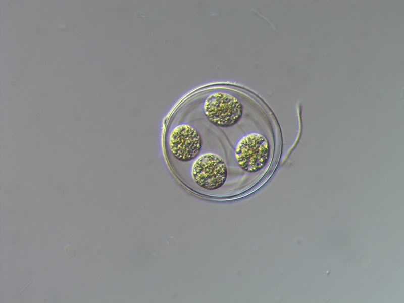 Sternenkugel Asterococcus superbus?