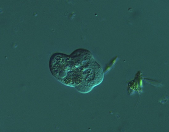 Amöbe Vahlkampfia? Kleine Animation + Einzelbilder