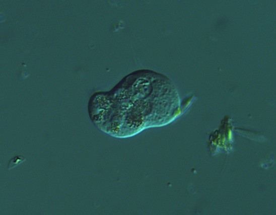 Amöbe Vahlkampfia? Kleine Animation + Einzelbilder