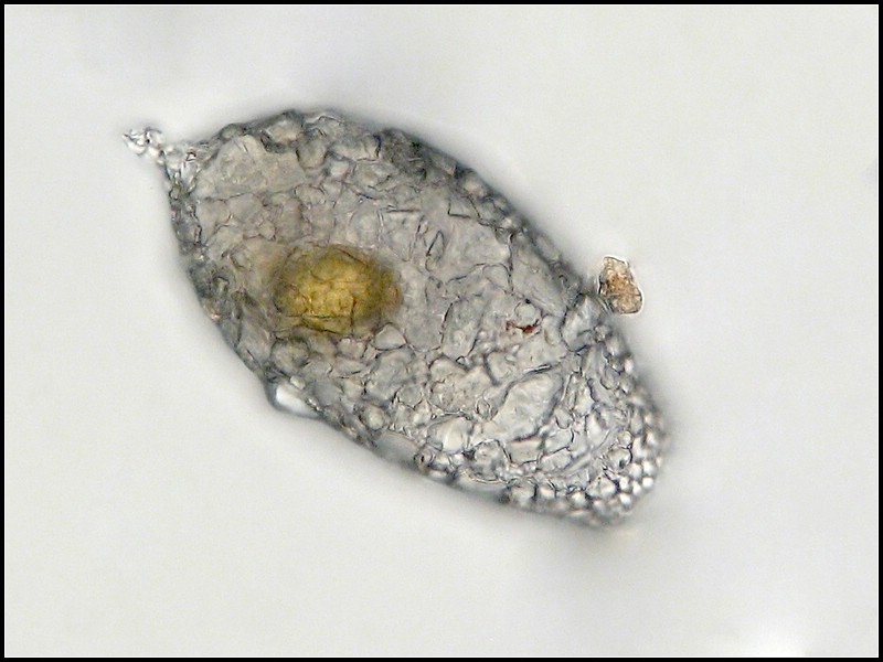 Schalenamöbe - Difflugia?