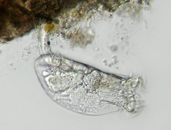 Rädertier Testudinella sp.