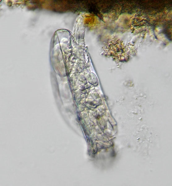 Rädertier Testudinella sp.