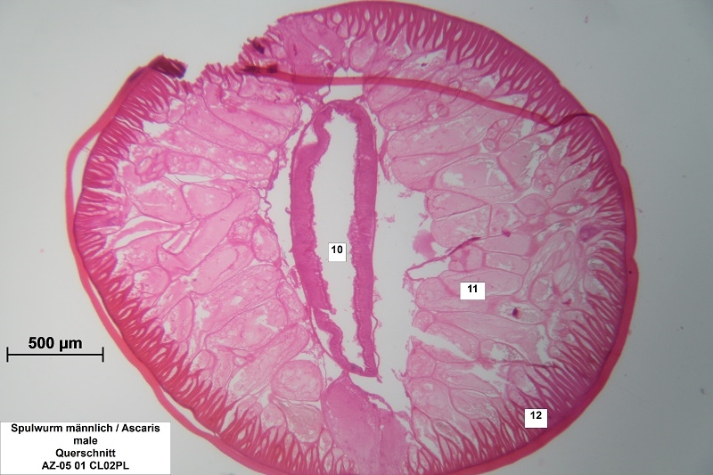 Zoologie: Spulwurm Ascaris