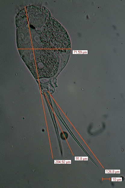 Einaugen-Rädertier Monommata longiseta?