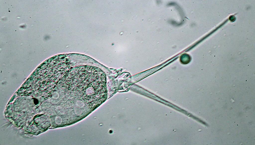 Einaugen-Rädertier Monommata longiseta?