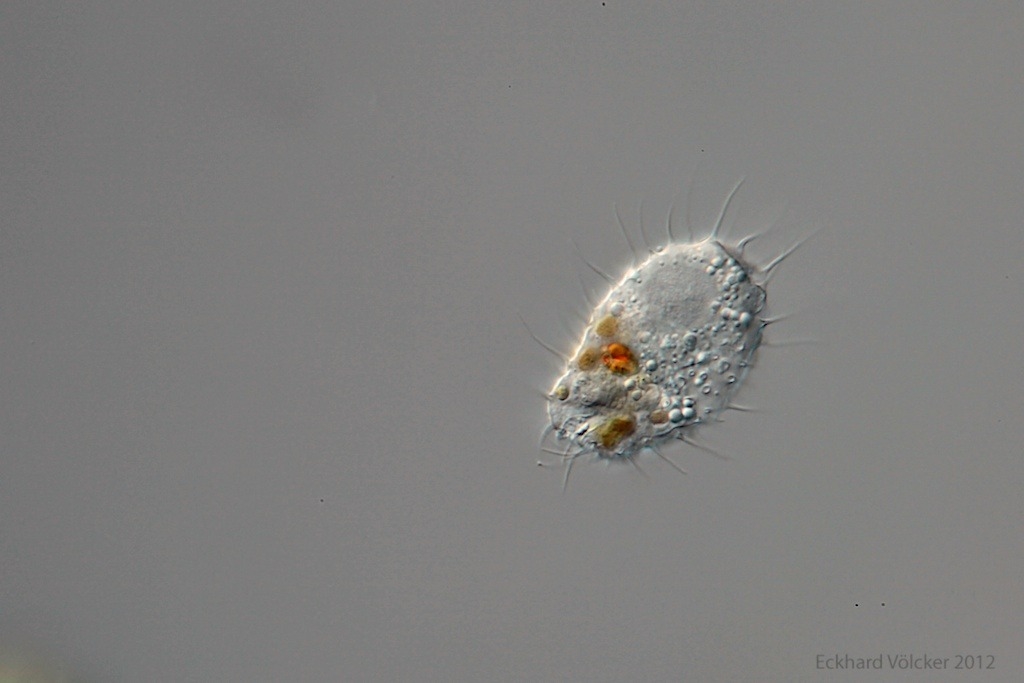 Arcella und Lecythium