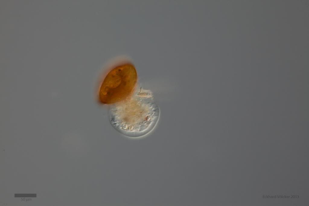 Arcella und Lecythium