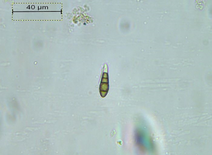 Plankton aus Brasilien