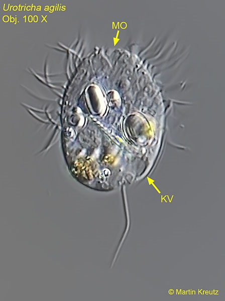 Urotricha agilis - Meister der Beschleunigung