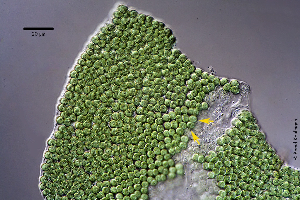 Cyanobakterien: Merismopedia?