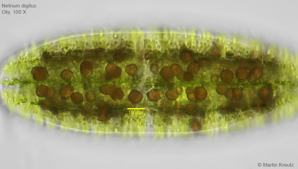 Kristalldrusen in Netrium digitus