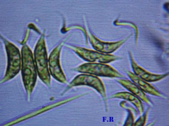 Scenedesmus Acuminatus