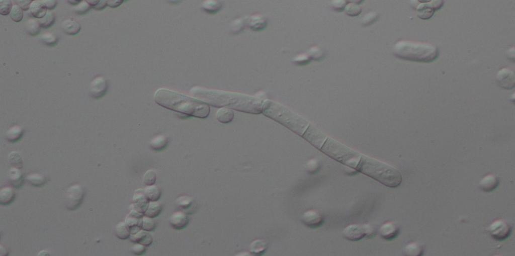 Backhefe mit Hyphen? (-->Pseudomyzelien)