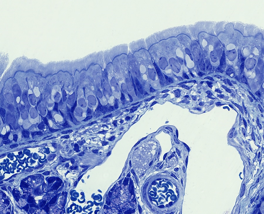 HISTOLOGIE: Nasenhöhle mit Flimmerzellen und Zilien