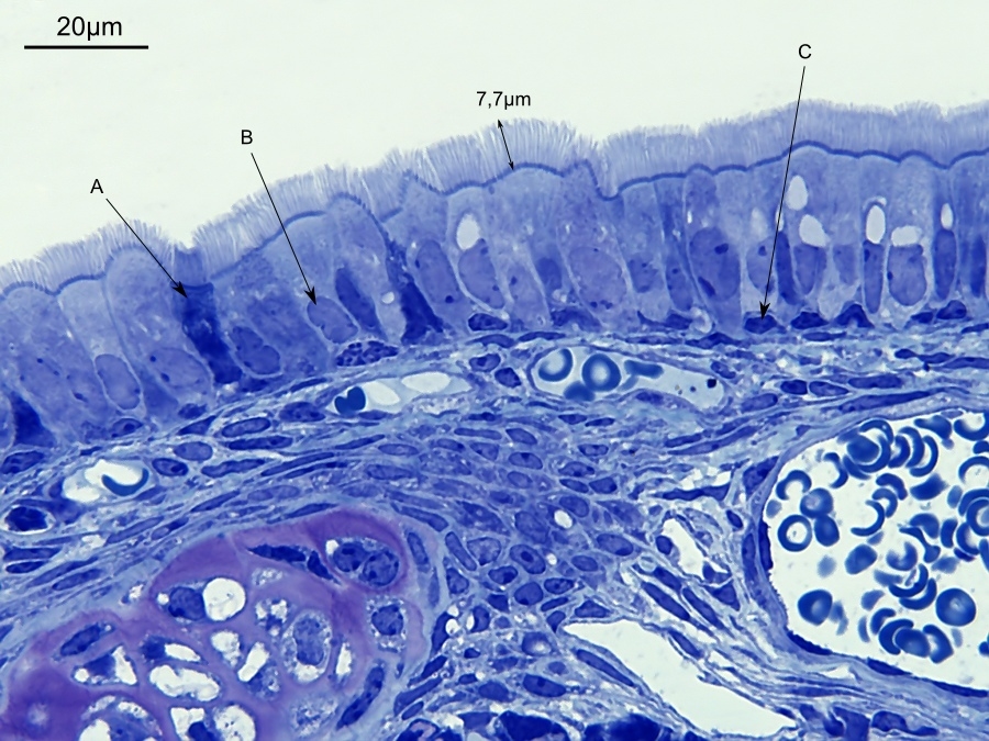 HISTOLOGIE: Nasenhöhle mit Flimmerzellen und Zilien