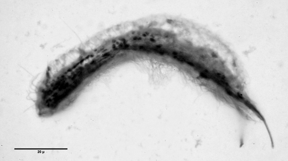 Gefärbte Dauerpräparate des Bauchhärlings Lepidodermella Squamata