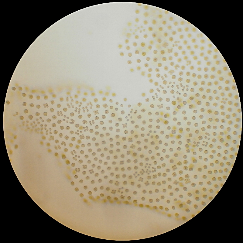 Tetraspora eine interessante Grünalge