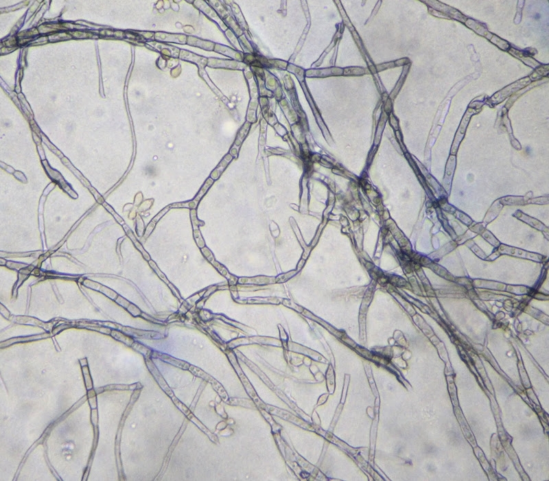 Pilz - wie Beginnen mit der Bestimmung?