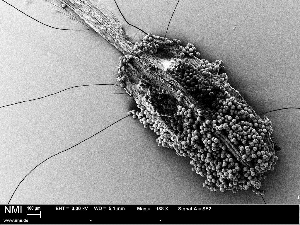 Kuckucks Lichtnelke Pollen im REM