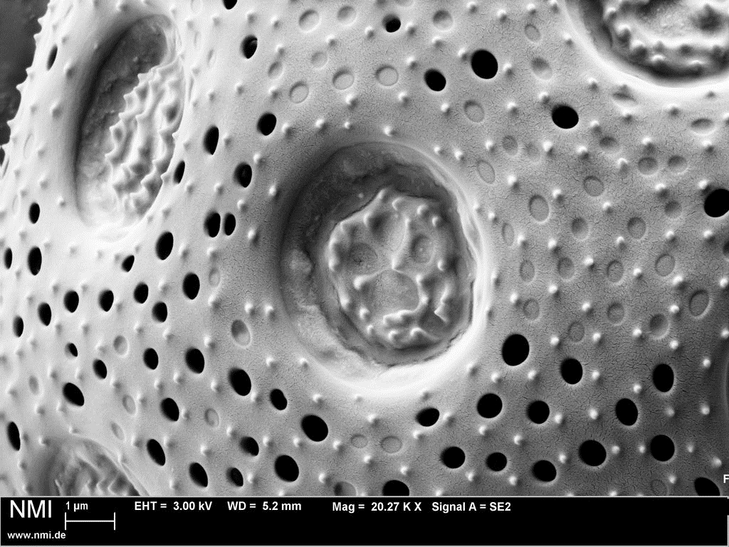 Kuckucks Lichtnelke Pollen im REM