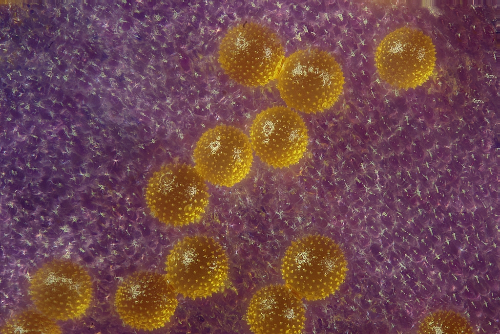 Pollen, Apfel und Hibiskus, Lichtmikroskop und REM