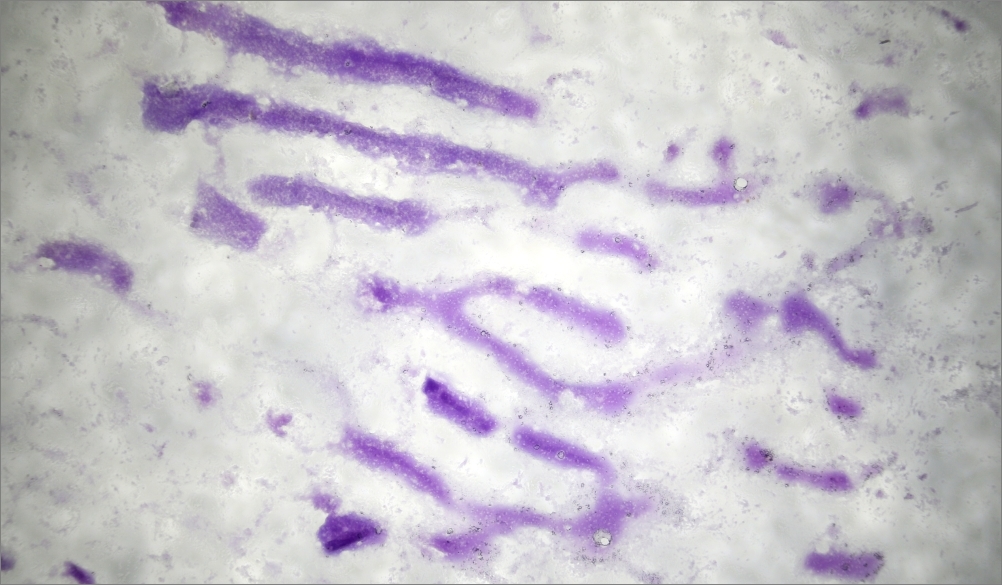 Ninhydrin & Ruhemanns Purpur