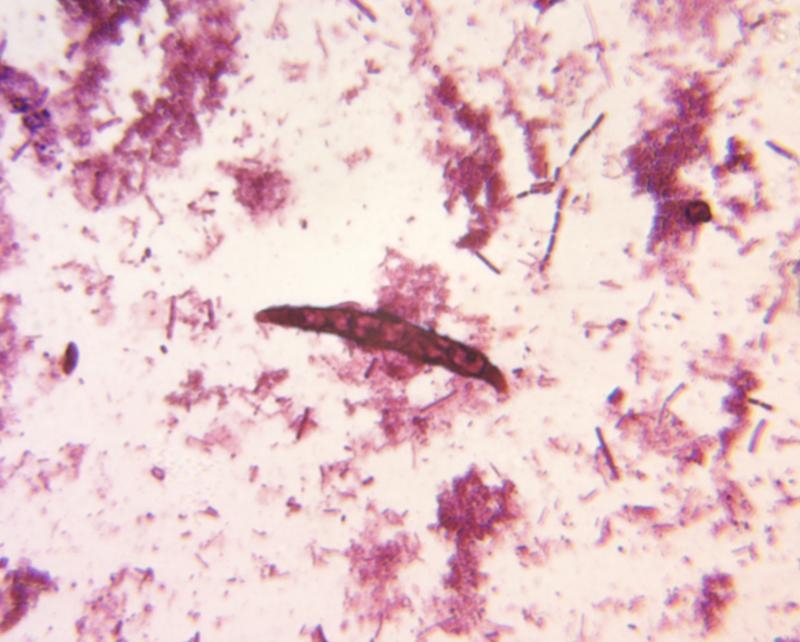 sporen, algen oder was? -geklärt-