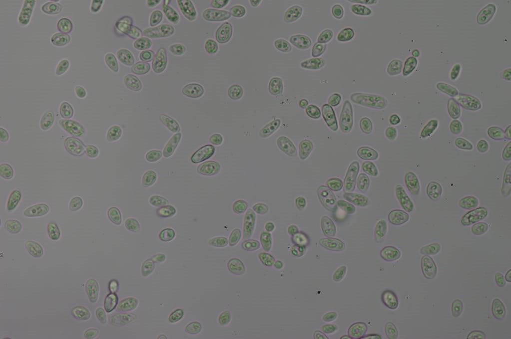 Welches Mikroskop zur Hefe-Beobachtung? - Seite 2