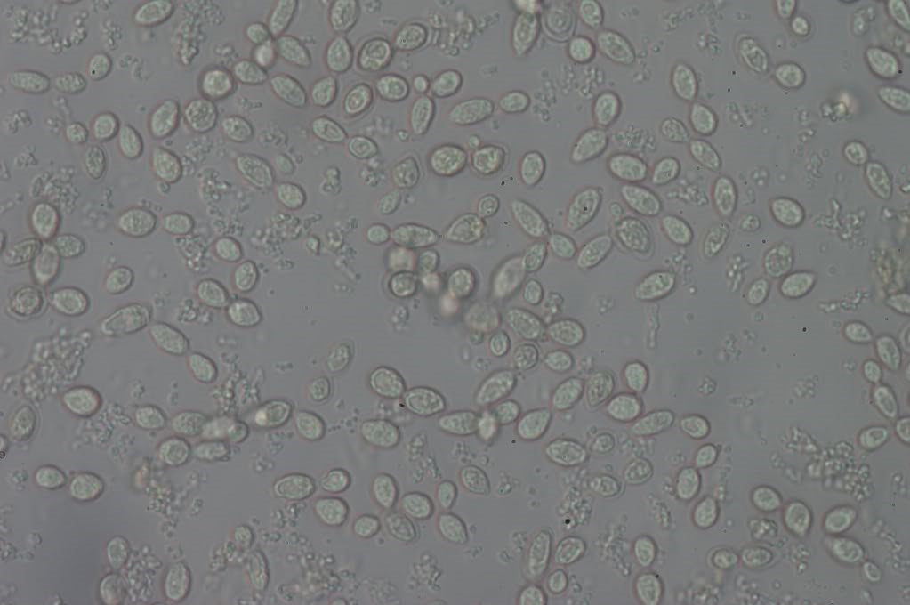 Welches Mikroskop zur Hefe-Beobachtung? - Seite 2