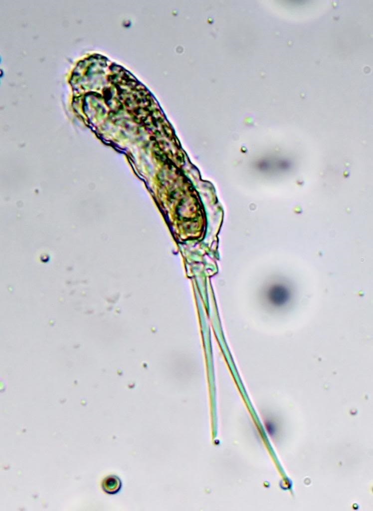 Einaugen-Rädertier Monommata longiseta?
