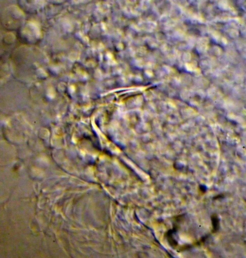 Einaugen-Rädertier Monommata longiseta?