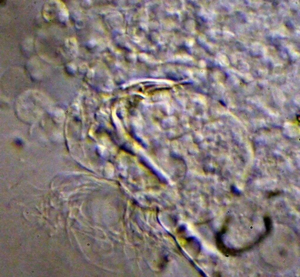 Einaugen-Rädertier Monommata longiseta?