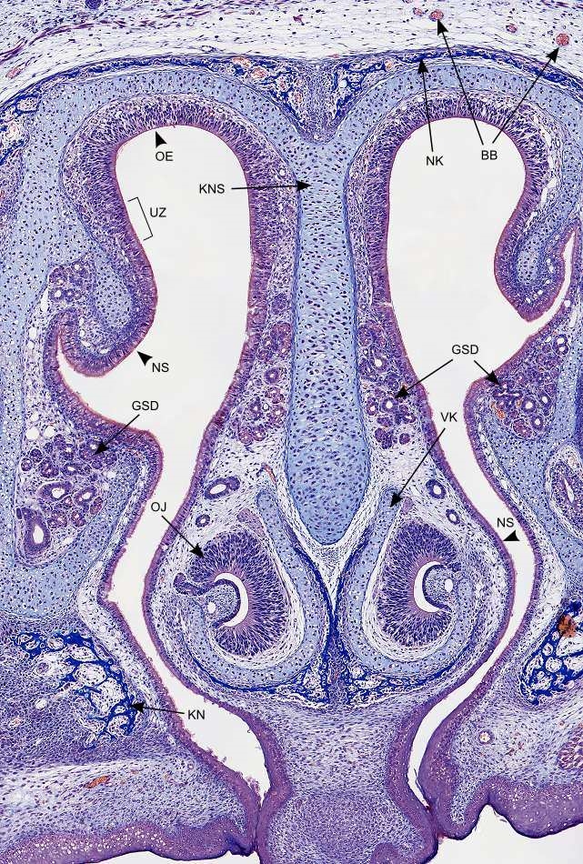 HISTOLOGIE: Nasenhöhle mit Flimmerzellen und Zilien