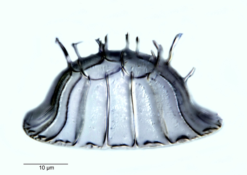 Stephanopyxis grossecellulata