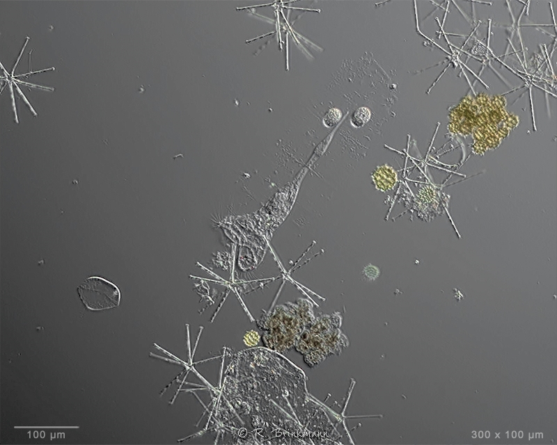 Collotheca im Gehäuse