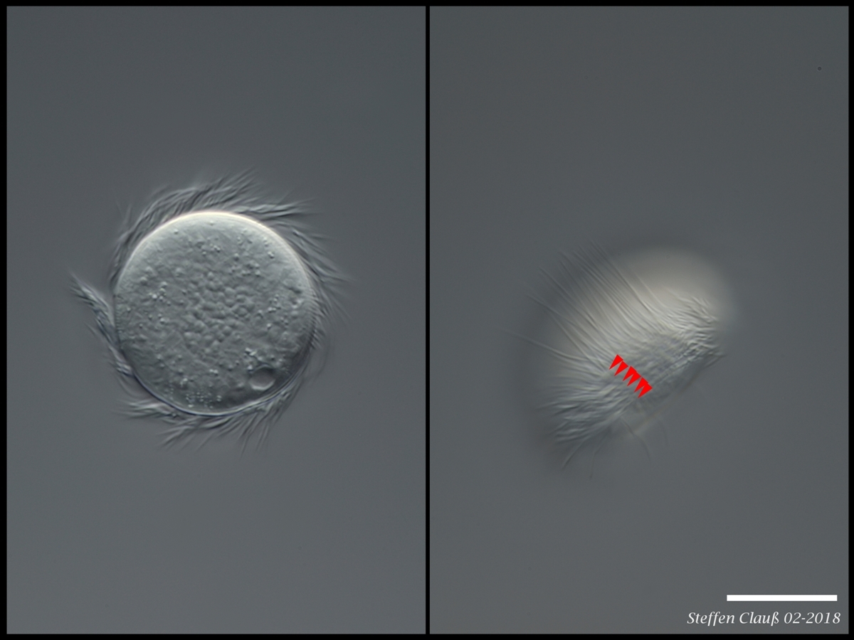 Trichophrya astaci - ein Sauginfusor