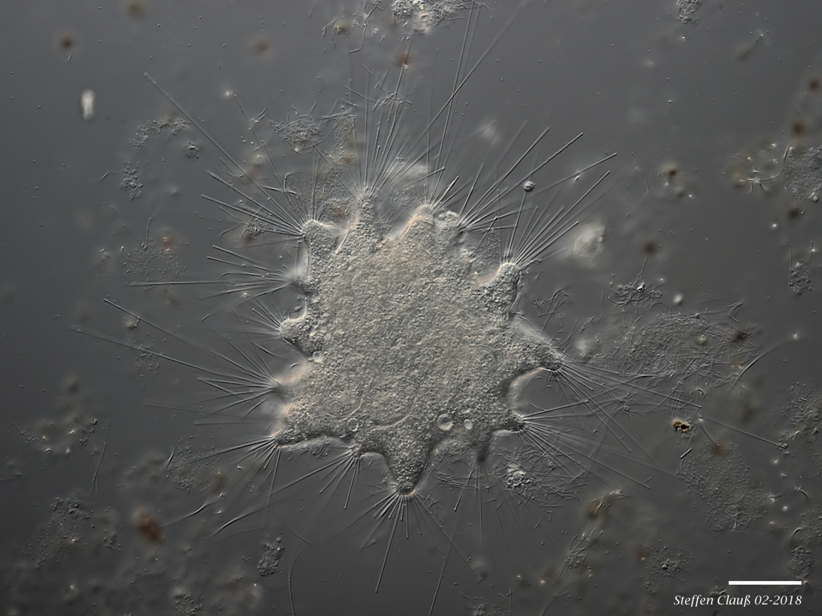 Trichophrya astaci - ein Sauginfusor